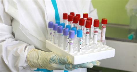 В России изменятся правила медосвидетельствования на состояние опьянения подробности Новости Mail