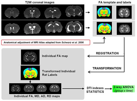 Scheme Of The Dti Data Processing Shrs Have Enlarged Ventricles