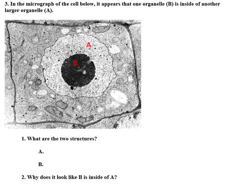 Solved Identify The Structures In An Electron Micrograph Chegg