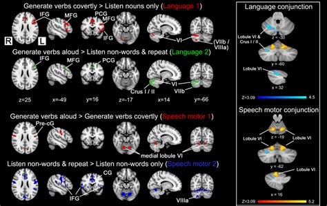 Language And Speech Motor Contrasts And Associated Conjunctions For The