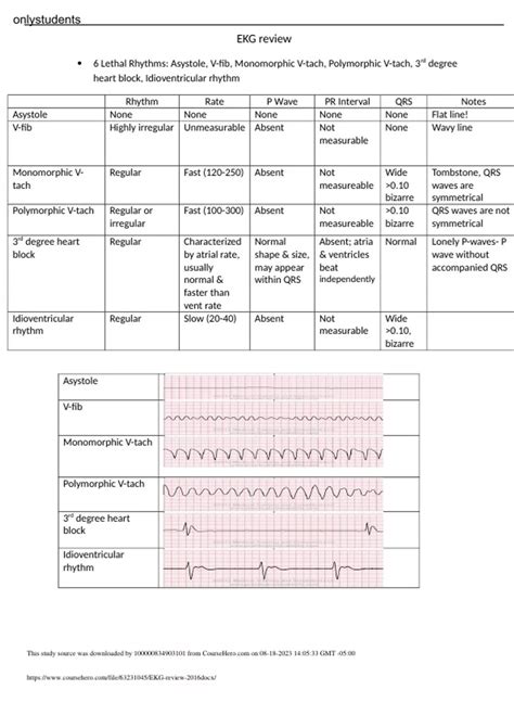 Ekg Review 6 Lethal Rhythms Asystole V Fib Monomorphic V Tach Ekg Review 6 Lethal Rhythms Asystole V Fib Monomorphic V Tach