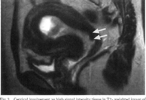 Figure 2 From The Value Of Pre Operative Diagnostic Procedures For