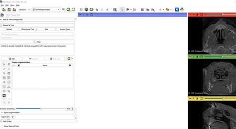 dentalsegmentator version of 2024 04 22 fails to load segmentation