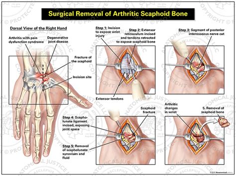 Scaphoid Bone Anatomy