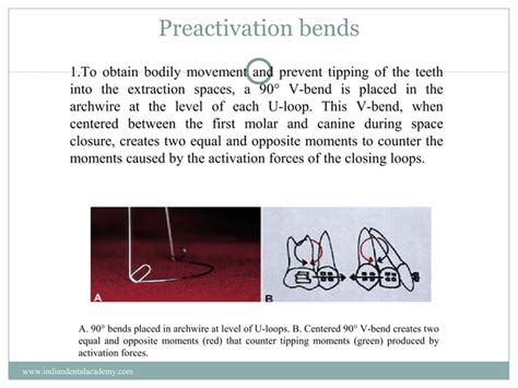 K Sir Loop Certified Fixed Orthodontic Courses By Indian Dental Academy PPT