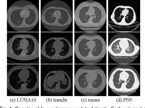Sgda Towards 3d Universal Pulmonary Nodule Detection Via Slice Grouped Domain Attention Paper