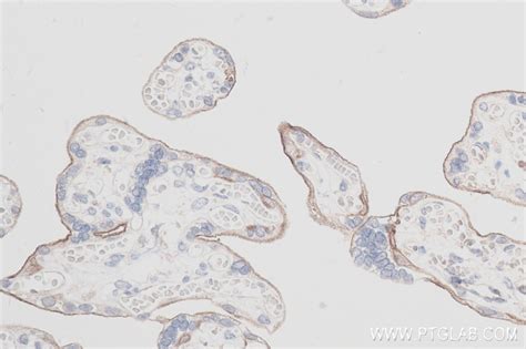 Egfr Antibody 83806 1 Rr Proteintech