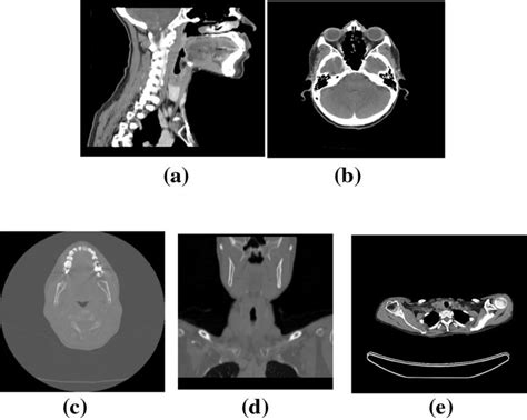 The Medical Images Chosen From Tcia Download Scientific Diagram