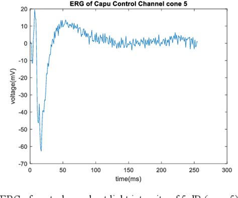 Figure 7 From Design Of Lowpass Filter And Wavelet Analysis For