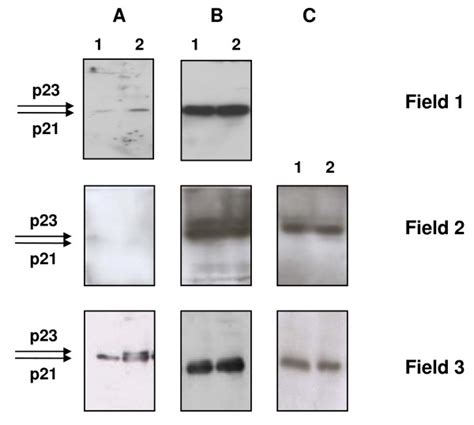 Expression Of Hcv Core Proteins Expression Of Hcv Core Protein Download Scientific Diagram