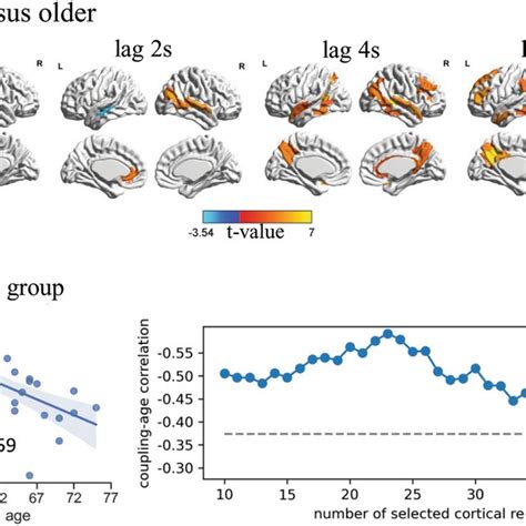 Reduced Listenerspeaker Neural Couplings With Aging A Direct Contrast Download Scientific