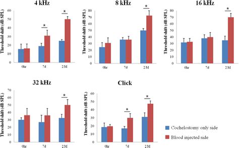 Auditory Brainstem Response Threshold Shifts At Just After Surgery 7 Download Scientific