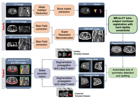 Proposed Pipeline For Joint Automated Segmentation Of Ct And Mr Pelvic Download Scientific