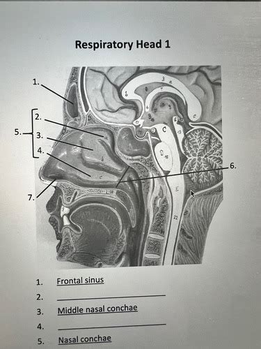 Respiratory Lab Practical Flashcards Quizlet