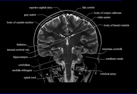 Cross Sectional Anatomy Of The Brain