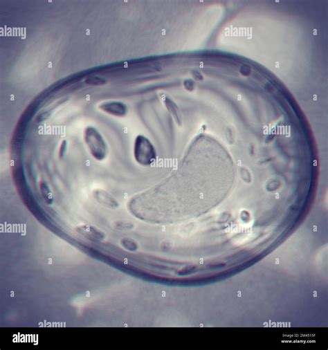 Abstract Cell Of Virus Or Pathogenic Bacterium Under Microscope