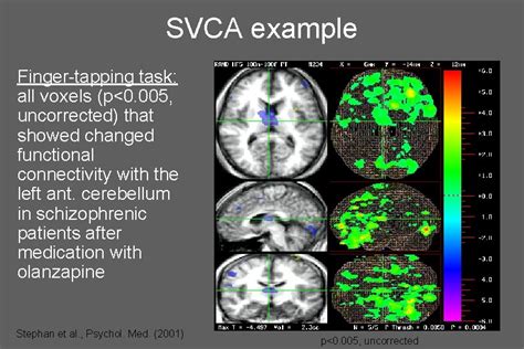 Effective Connectivity Dynamic Causal Modelling Dcm Meike J
