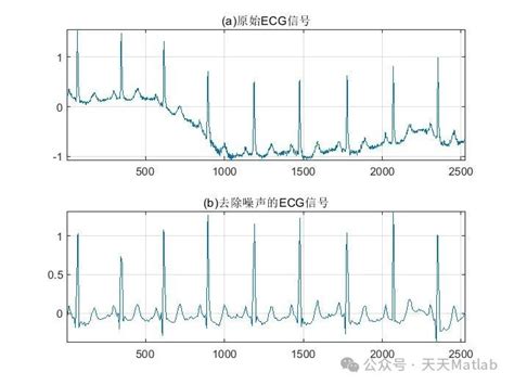 【心电信号】基于小波变换实现心电信号ecg降噪和qrs波检测附matlab代码 心电信号降噪 csdn博客