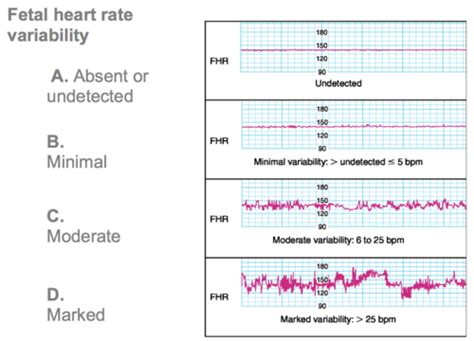 Ch 9 Fetal Heart Rate Assessment Flashcards Quizlet