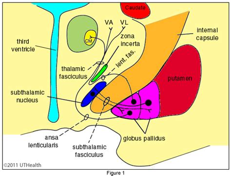 Lentiform Nucleus
