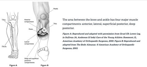 Personal Story What Is Compartment Syndrome Mandi Mitchell