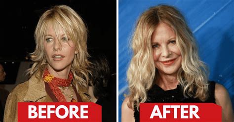 Meg Ryan Before And After Plastic Surgery The Secret Behind Actress Age Defying Look