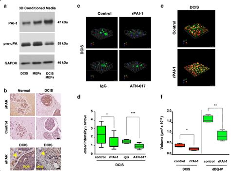 Analysis And Targeting Of The Plasminogen Activation Pathway Results In