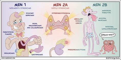 Multiple Endocrine Neoplasia Men Syndrome Medical Junction