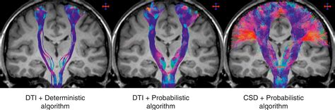 Diffusion Tensor Imaging Clinical Tree