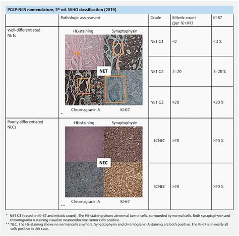 Gep Nen Nomenclature 5th Ed Who Classification 2019 Download
