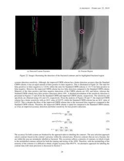 Long Bone Fracture Detection Using Artificial Neural Networks Based On Contour Features Of X Ray