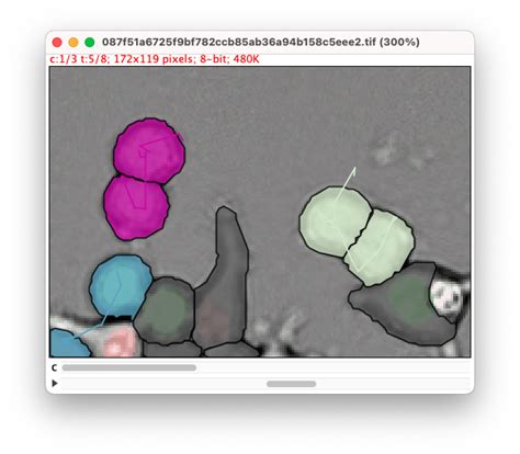 Trackmate Splitting Event Settings Image Analysis Image Sc Forum