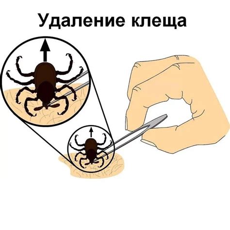 Как правильно вытащить клеща у собаки в домашних условиях