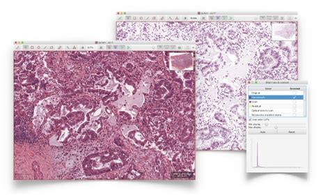 Home · Qupathqupath Wiki · Github