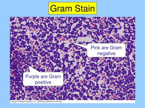 PPT Chapter Prokaryotes PowerPoint Presentation Free Download ID