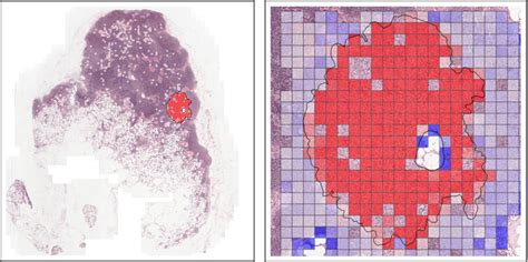 The Classification Result Of The Proposed Method In Camelyon16 Dataset Download Scientific
