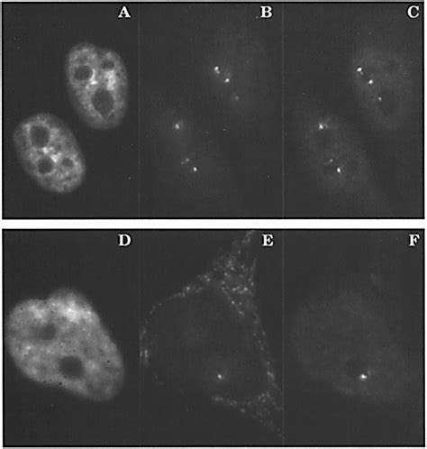 The Polypyrimidine Tractbinding Protein Hnrnp I Is Concentrated In