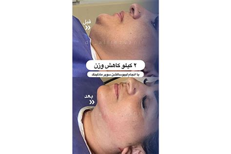 دکتر علی رضوانی، پزشک زیبایی