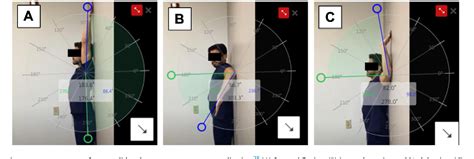 Figure 1 From Remote Visual Estimation Of Shoulder Range Of Motion Has Generally High
