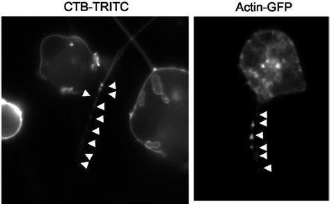 Punctate Staining Pattern For Lipid Rafts And Actin Along The Length Of Download Scientific