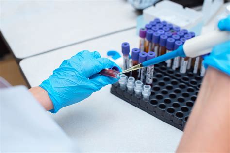 Screening For Celiac Disease