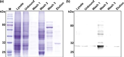 Heterologous Expression And Purification Of Haloferax Volcanii Dacz In Download Scientific