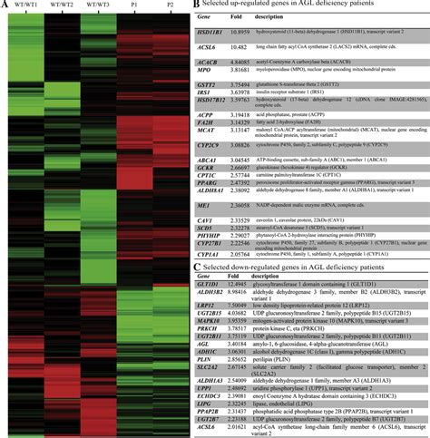 Transcriptome Analysis Of The Ebv B Cells From P1 And P2 A Cluster