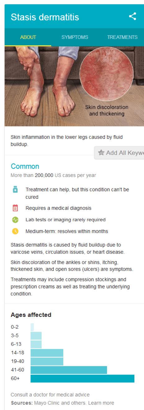 Stasis Dermatitis Eczema On Legs Causes And Treatment
