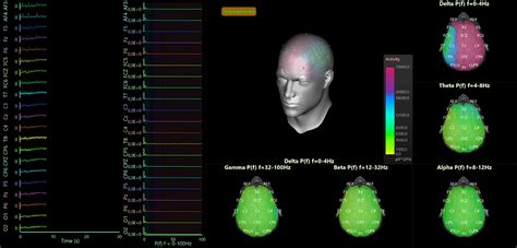 3d Medical Imaging Visualization Of Multimodal Medical Data