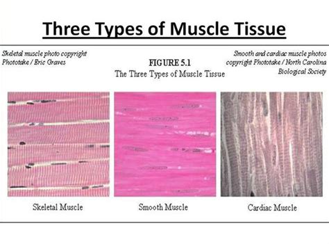Skeletal Muscle Histology Drawing