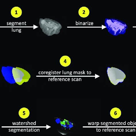 3d Image Preprocessing Steps For Lung Tumor Segmentation Download