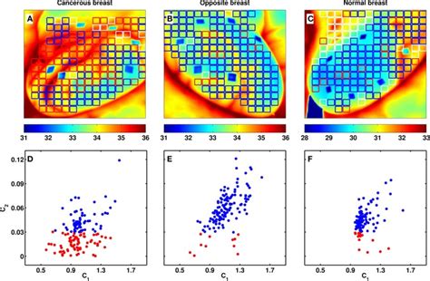 Breast Wide Multifractal Analysis Of Skin Temperature Temporal Download Scientific Diagram