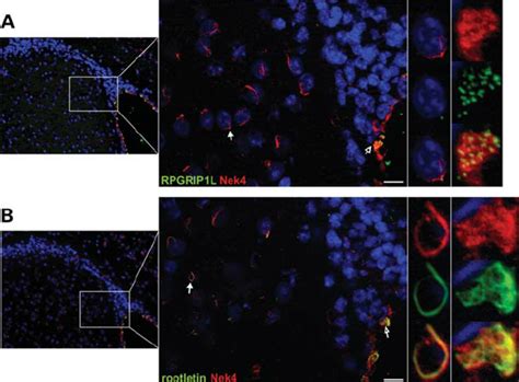 Subcellular Localization Of Nek4 In Rat Brain A Nek4 Red Upper