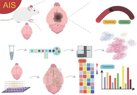New Insights Into Acute Ischemic Stroke From The Perspective Of Spatial